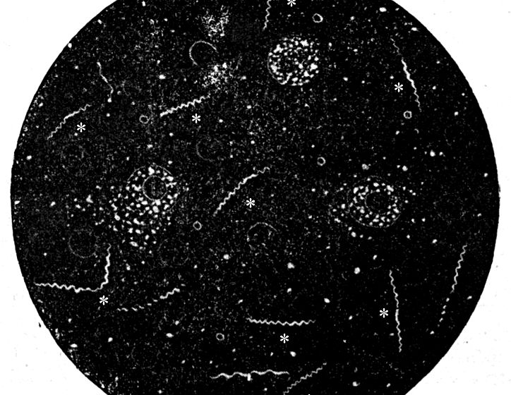 Dark-Field Microscopy and CFS/Lyme | CFS Remission